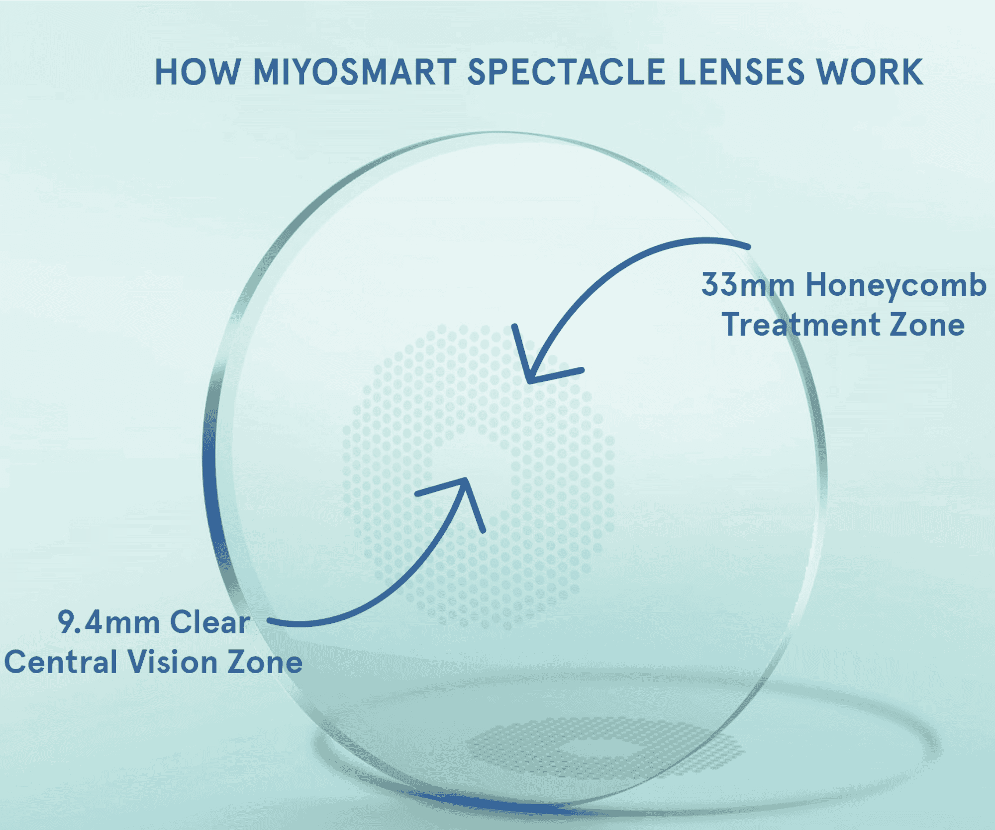 MiYOSMART Spectacle Lenses | Blackheath Eyecare Opticians | Charlton ...