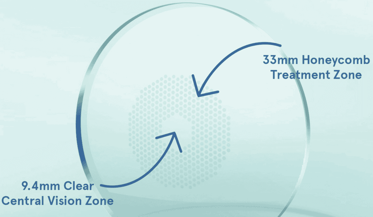 Miyosmart | Eyediology Opticians London Opticians | East London Opticians