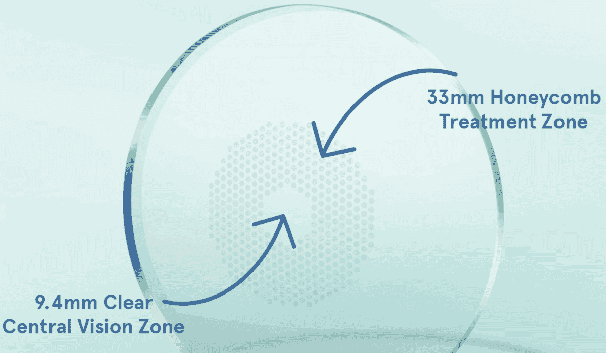 Miyosmart | Eyediology Opticians London Opticians | East London Opticians